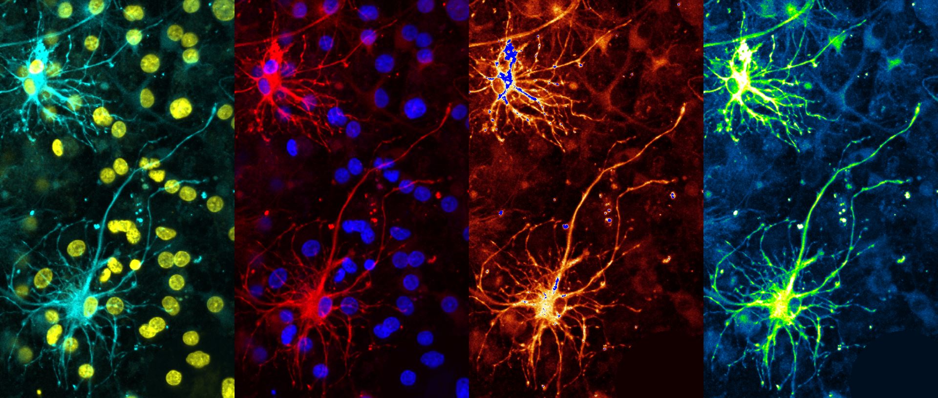 Elon Musk's Neuralink And The Advanceed Brain-Machine Interfaces